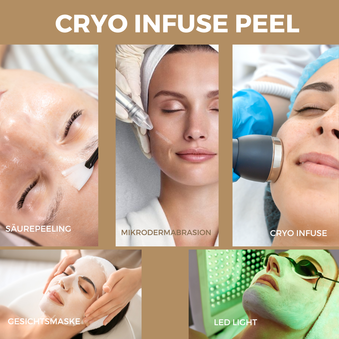 Cryo Infuse Peel